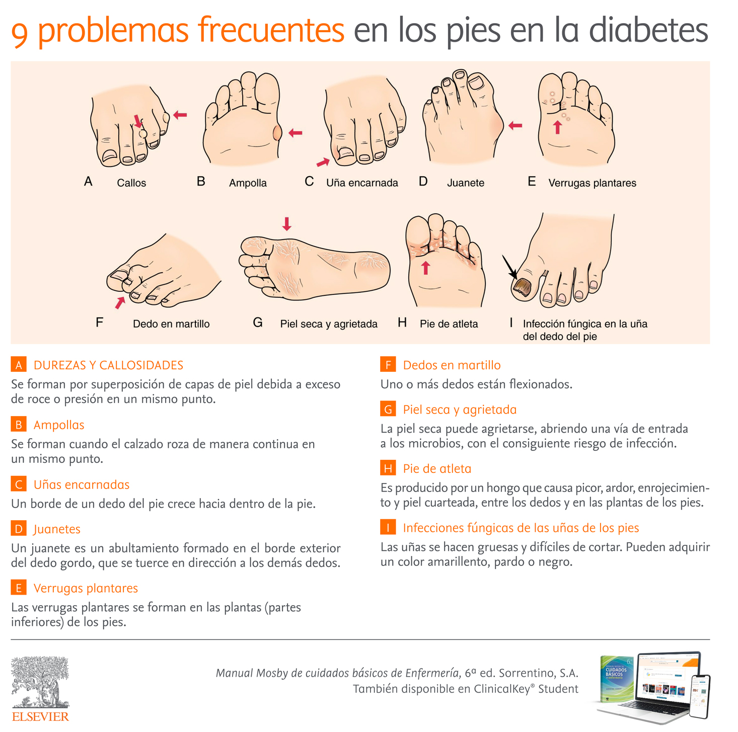 Problemas de pies: guía a sus dolencias comunes - Blog naturabeauty